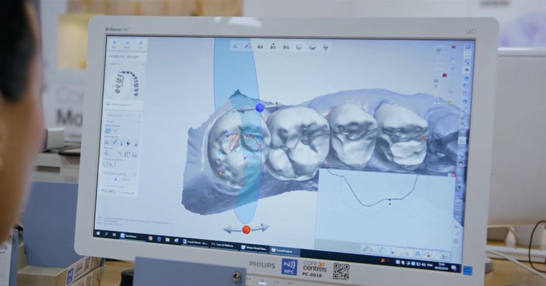 NextDent 5100 – 3D-Drucker | 3D Systems